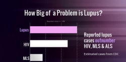 Lupus facts - Infographic
